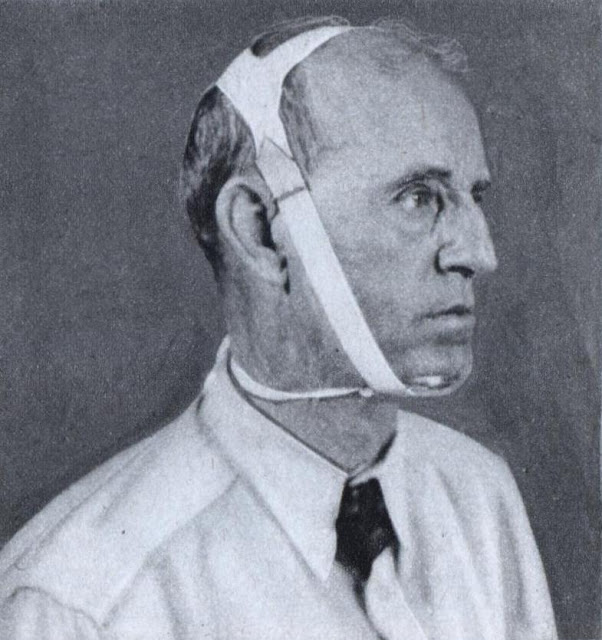 Chin Plate Stops Mouth Breathing, 1936 | Vintage News Daily
