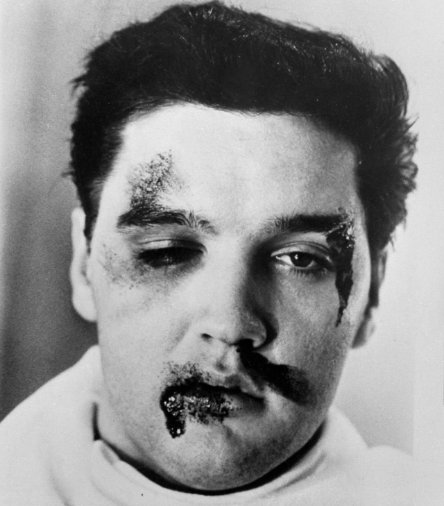 The Battered and Bruised Face of Elvis Presley Should Shock Some of His ...