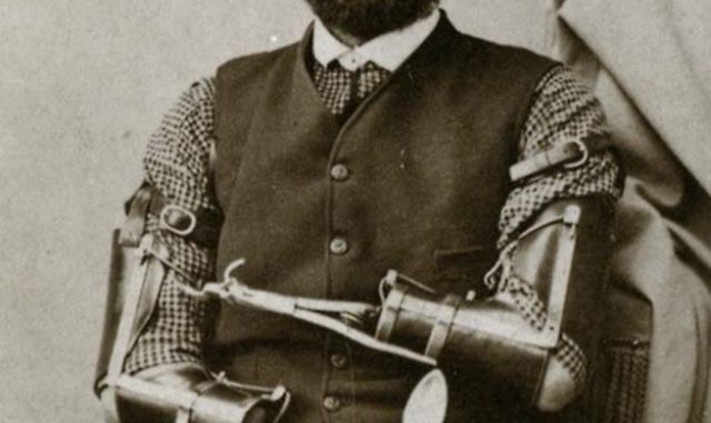 Civil War Veteran Samuel Decker Posing With Prosthetic Arms He Designed ...